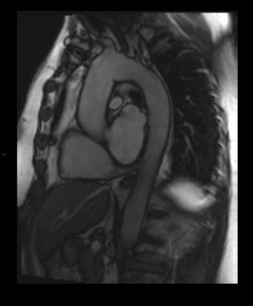 Imaging Data - British Heart Foundation - Data Science Centre